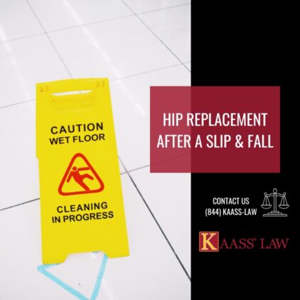 Hip Replacement After A Slip & Fall - KAASS LAW